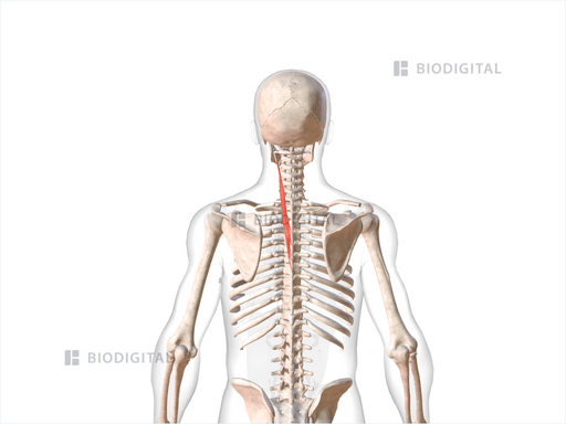 Left splenius cervicis | BioDigital Anatomy