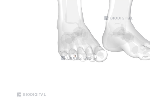 Distal phalanx of right fourth toe | BioDigital Anatomy