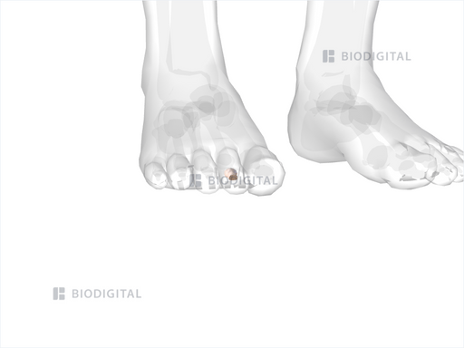 Middle phalanx of right second toe | BioDigital Anatomy