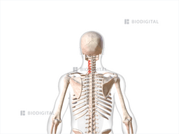Left rotatores cervicis | BioDigital Anatomy