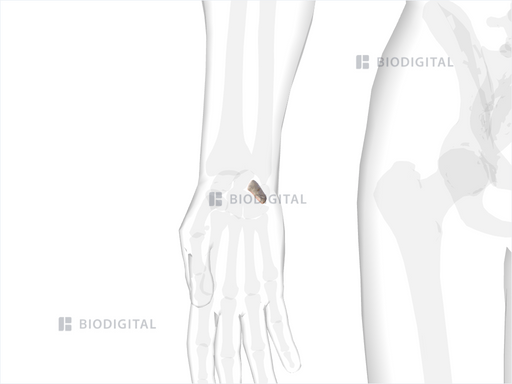 Right triquetrum | BioDigital Anatomy