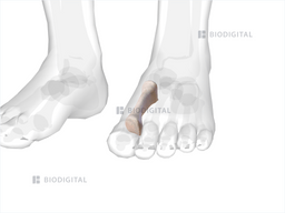 Left first metatarsal | BioDigital Anatomy