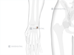 Right pisiform | BioDigital Anatomy