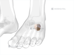 Left cuboid | BioDigital Anatomy