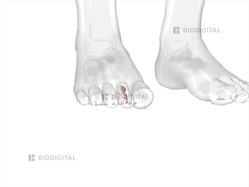 Phalanges of right second toe | BioDigital Anatomy