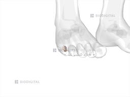 Proximal phalanx of right fifth toe | BioDigital Anatomy