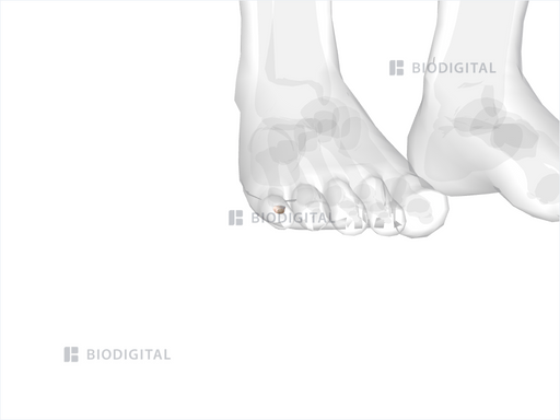 Middle phalanx of right fifth toe | BioDigital Anatomy