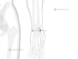 Left scaphoid | BioDigital Anatomy
