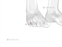 Phalanges of right fifth toe | BioDigital Anatomy